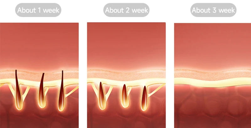 Ice Cooling IPL Hair Removal Device FDA & SFDA & CFDA medical certifie ...